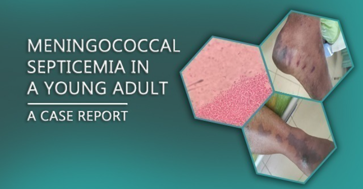 Meningococcal Septicemia in a Young Adult – A Case Report | PGIM